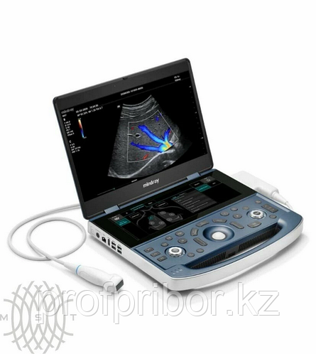 УЗИ аппарат Mindray MX7 портативный, купить в Казахстане, цена на Satu.kz